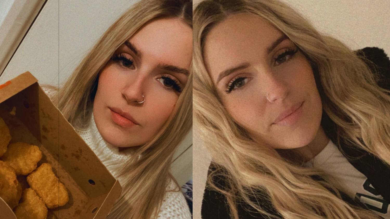 Velvet - Élet - Ez a fiatal nő 22 éve chicken nuggets-en él