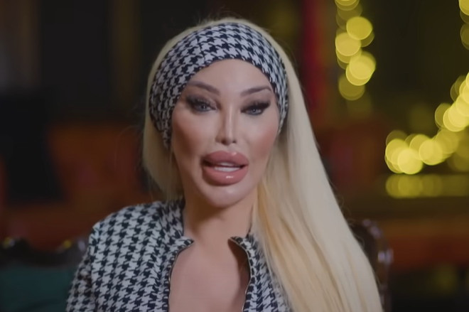 Index - Mindeközben - A világ leghíresebb plasztikafüggője, Jessica ...