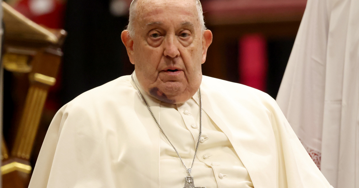 Index - Külföld - Ferenc pápa elesett, beverte a fejét