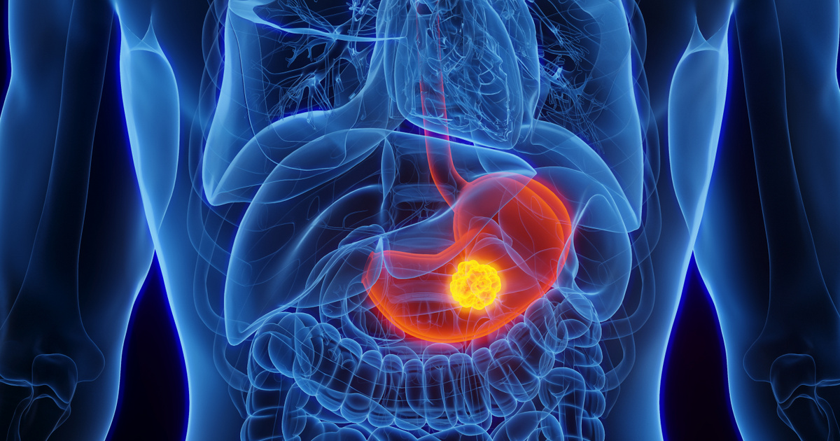 Apple Develops Lisa: The First Computer with GUI and Mouse - NewsyList